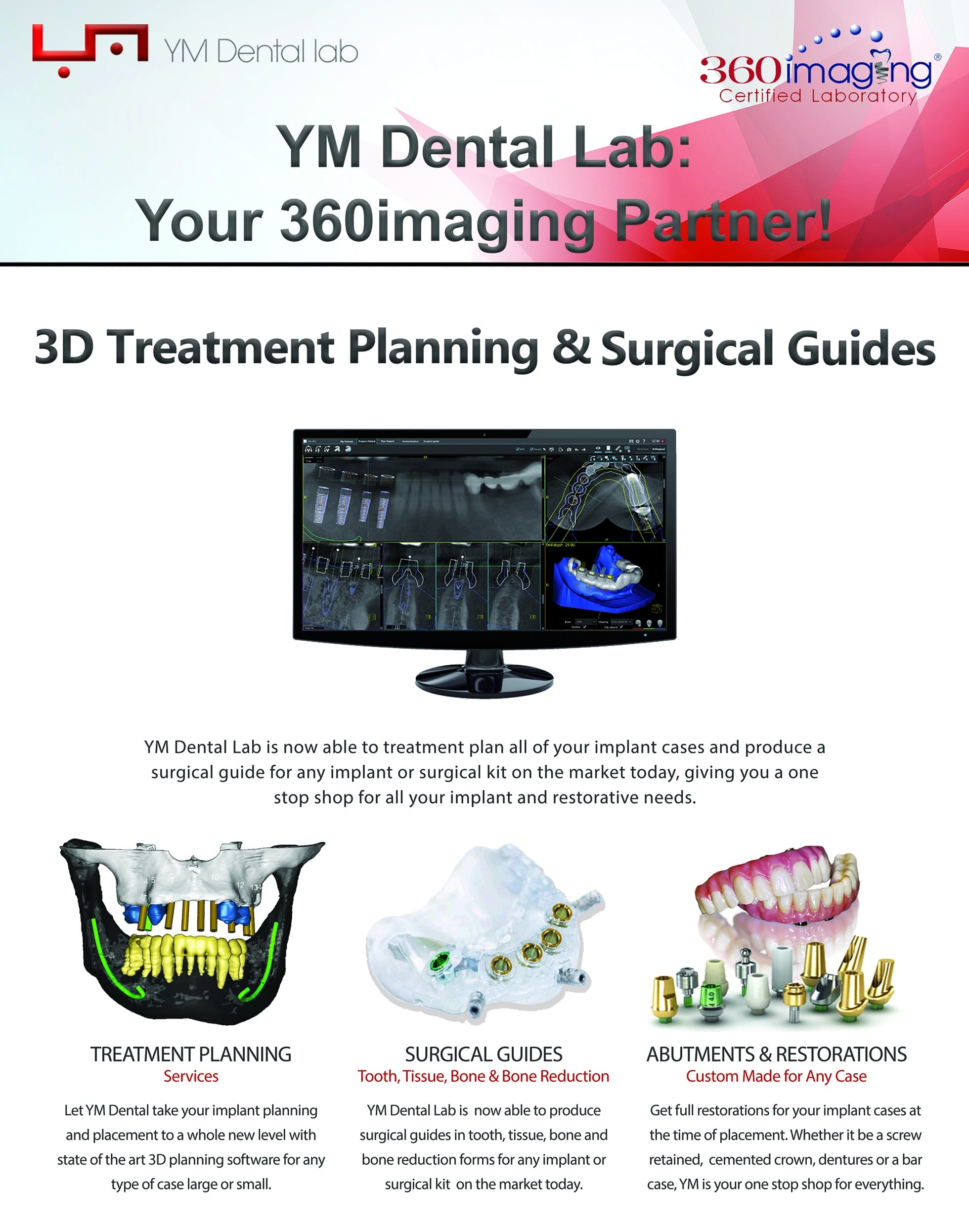 CT Scan Implant Surgical Guide - YM Dental Lab